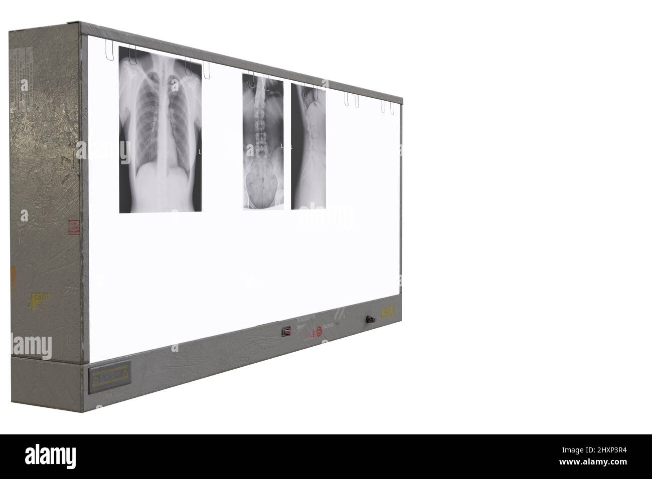 x-ray film viewer isolated on white background 3d illustration Stock ...