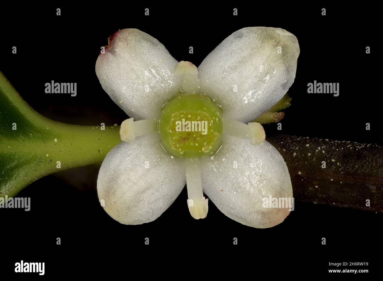 Normal flora hi-res stock photography and images - Alamy