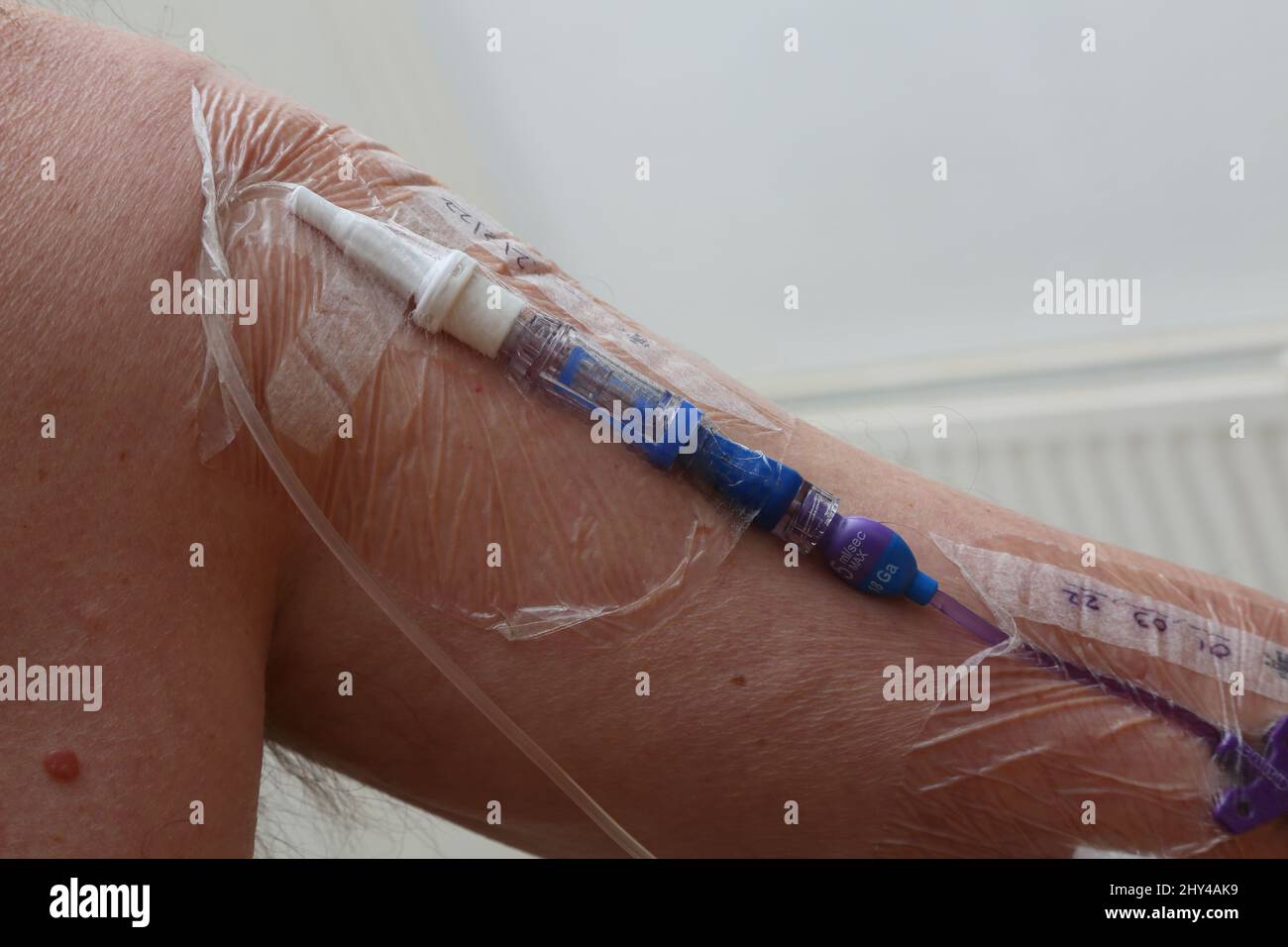 Iv Infusion Picc Line