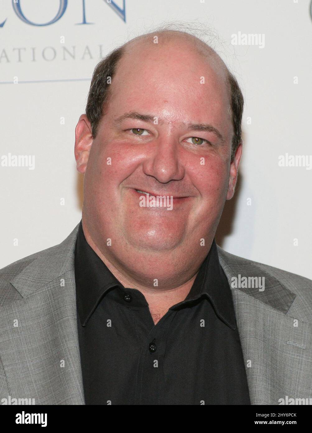 Brian Baumgartner Missing Teeth
