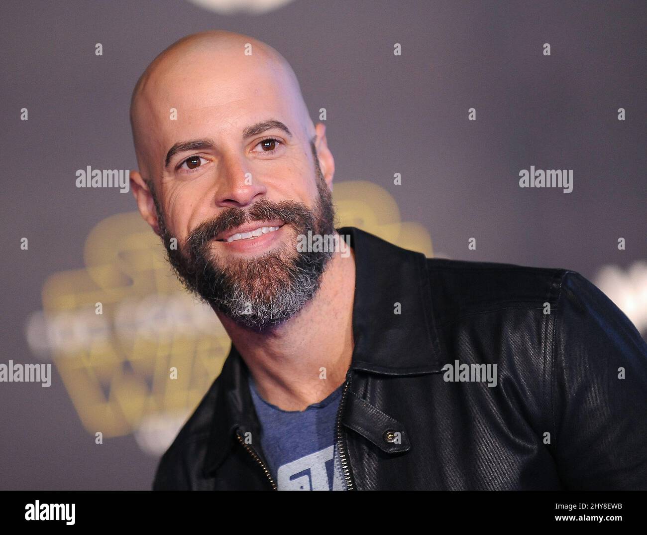 Chris Daughtry Hair Transplant