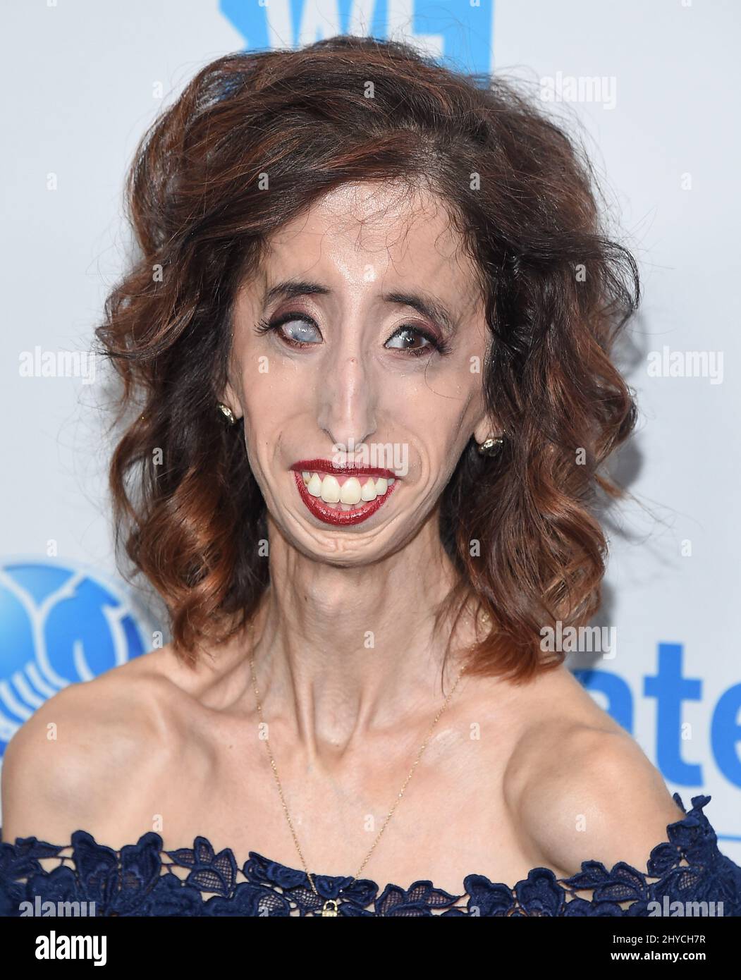 Lizzie Velasquez attending WE Day held at The Forum in Los Angeles, USA ...