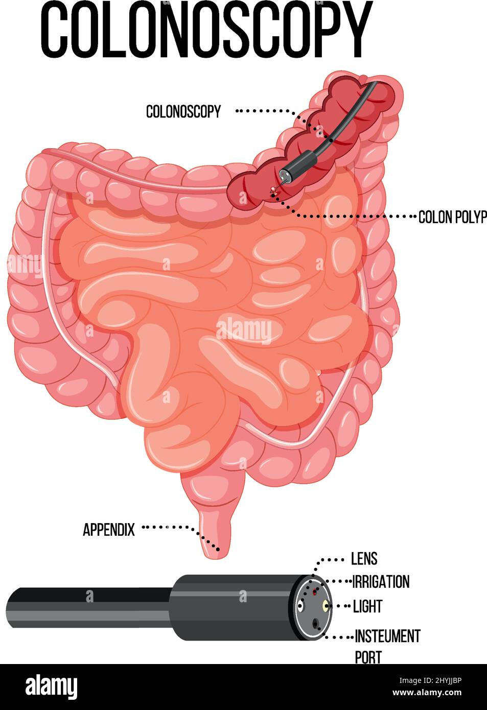 Diagram showing colonoscopy in human illustration Stock Vector Image ...