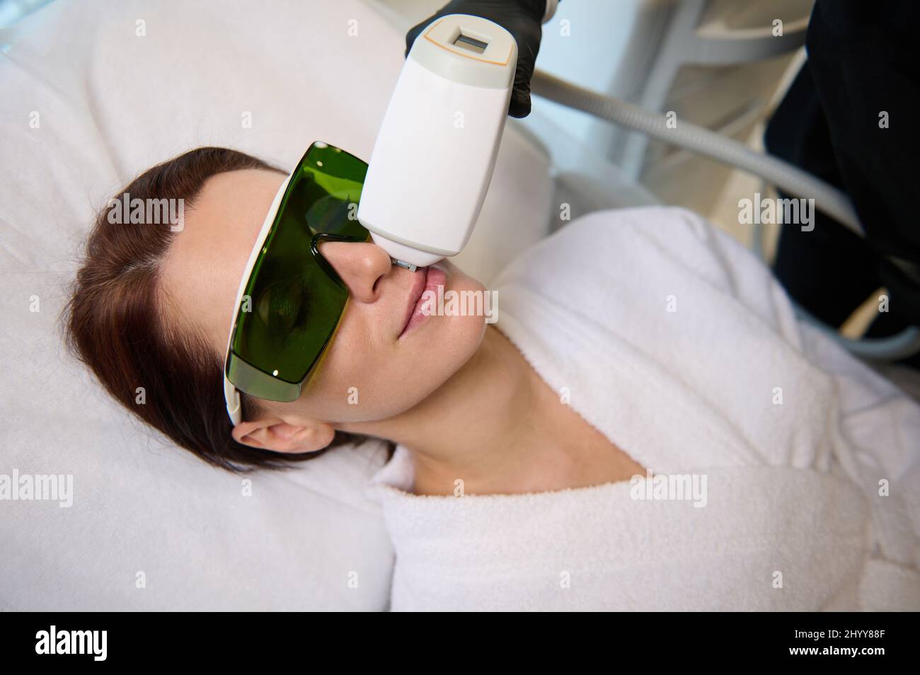 Elos epilation hair removal procedure on the face of a beautiful woman ...