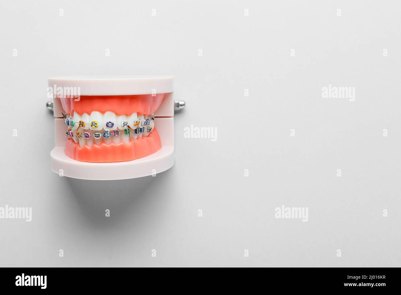 Model of jaw with dental braces on light background Stock Photo - Alamy