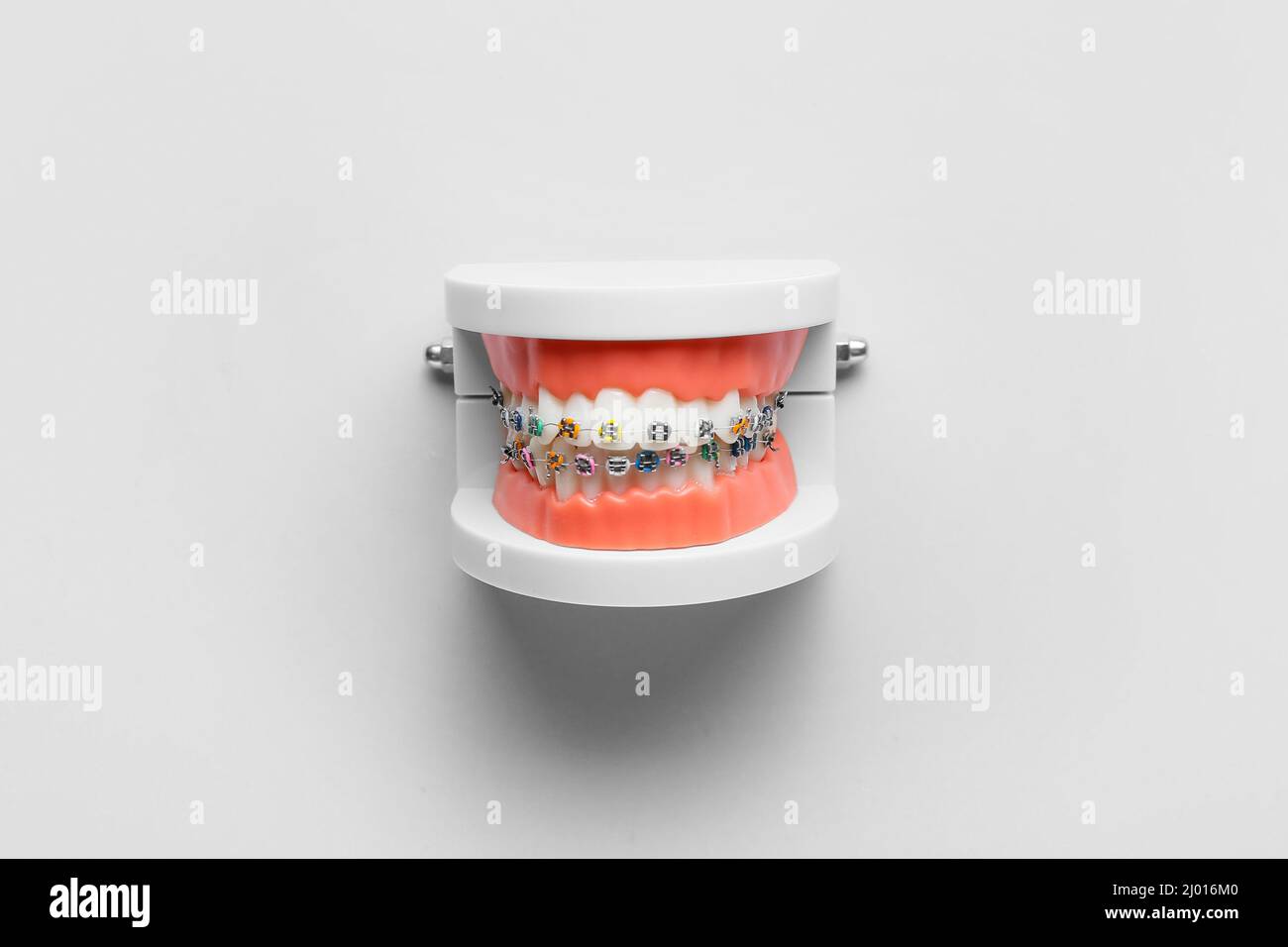 Model of jaw with dental braces on light background Stock Photo - Alamy