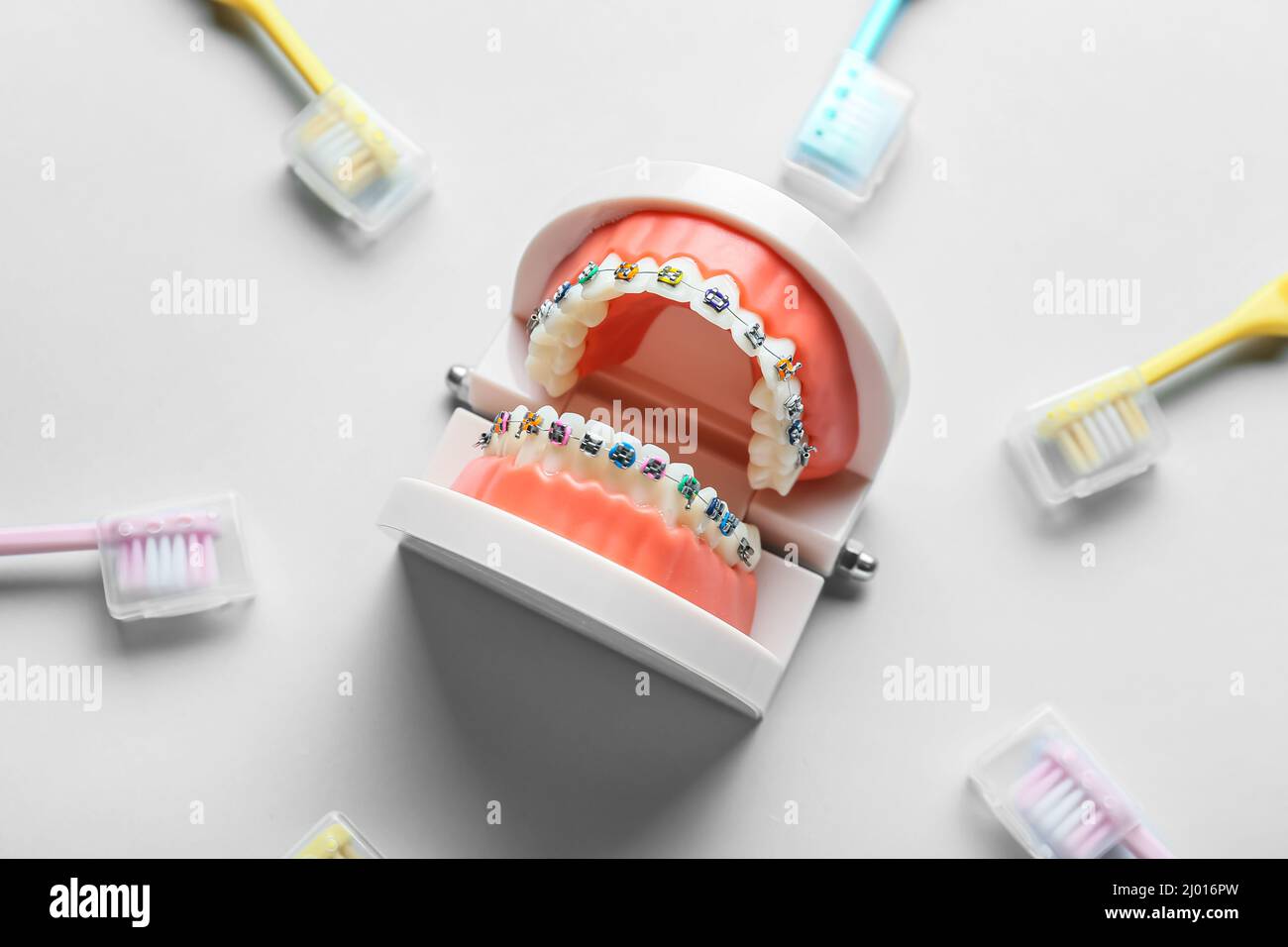 Model of jaw with dental braces and toothbrushes on light background ...