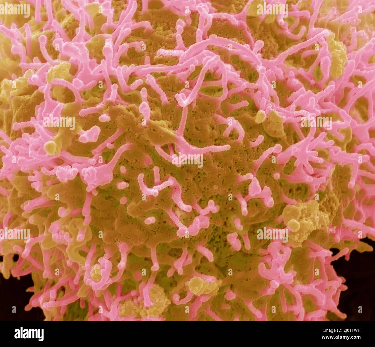 Ebola virus, SEM Stock Photo - Alamy