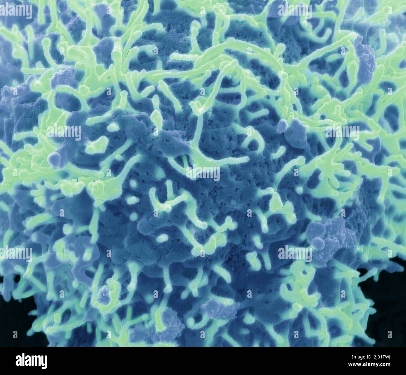 Ebola virus, SEM Stock Photo - Alamy