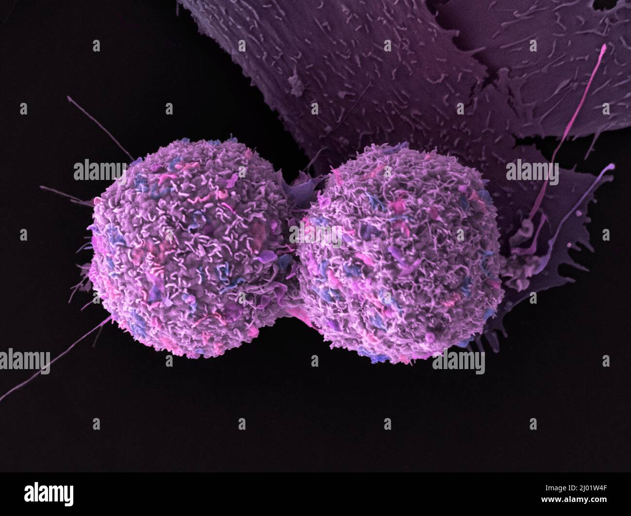 Lung cancer cells dividing, SEM Stock Photo - Alamy