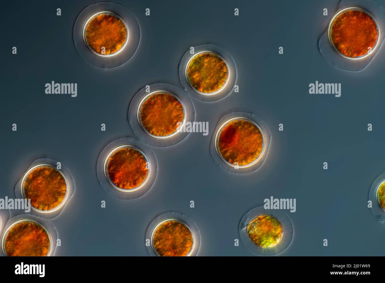 Haematococcus sp, algae, light micrograph Stock Photo - Alamy
