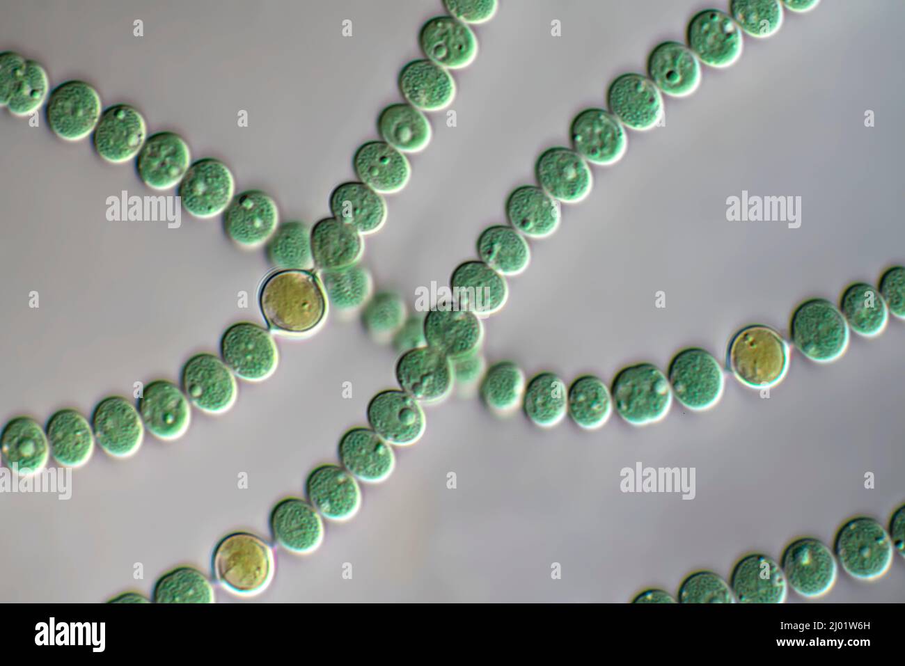 Anabaena sp, algae, light micrograph Stock Photo - Alamy