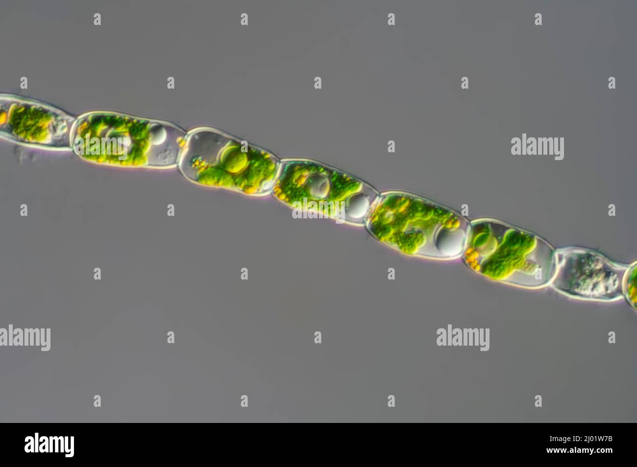 Trentepohlia sp, algae, light micrograph Stock Photo - Alamy