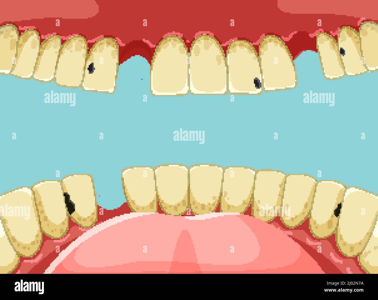 Broken tooth tongue hi-res stock photography and images - Alamy