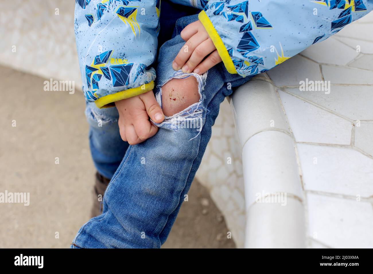 Boy a wound knee hi-res stock photography and images - Alamy