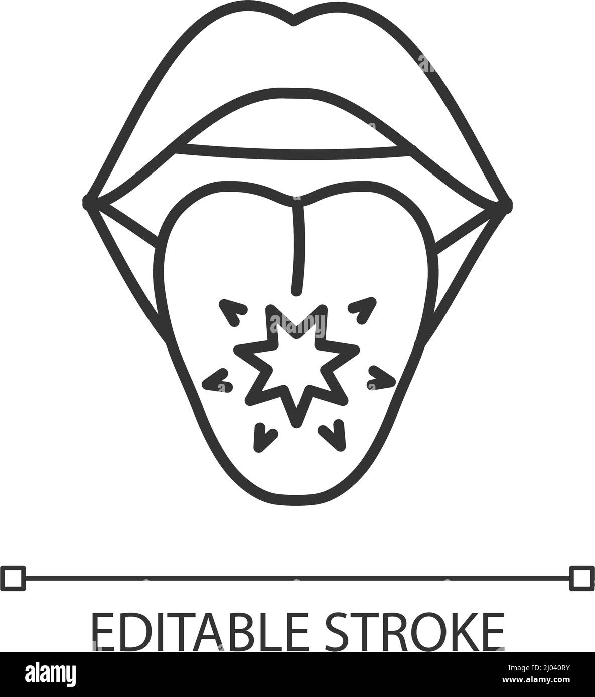 Tongue tumor hi-res stock photography and images - Alamy