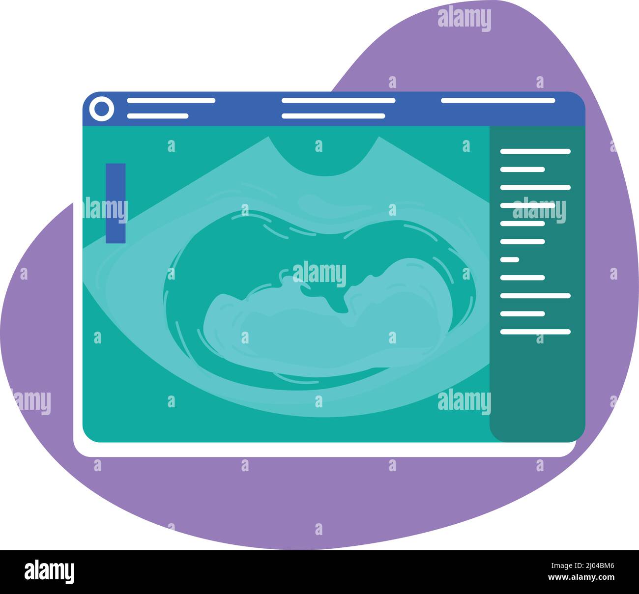 Fetal ultrasound 2D vector isolated illustration Stock Vector Image ...