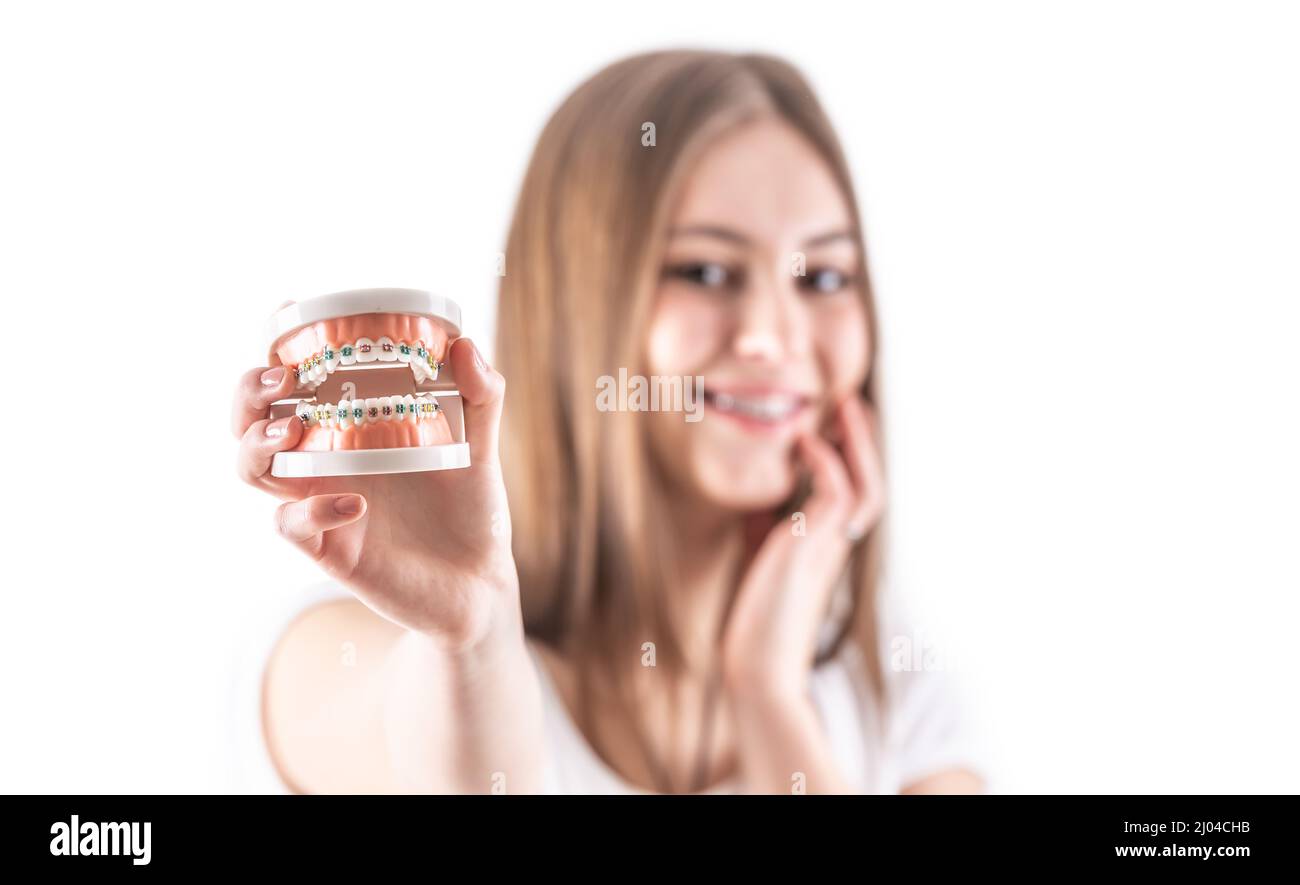 Model of a dental braces in the hand of a young teenage girl Stock ...