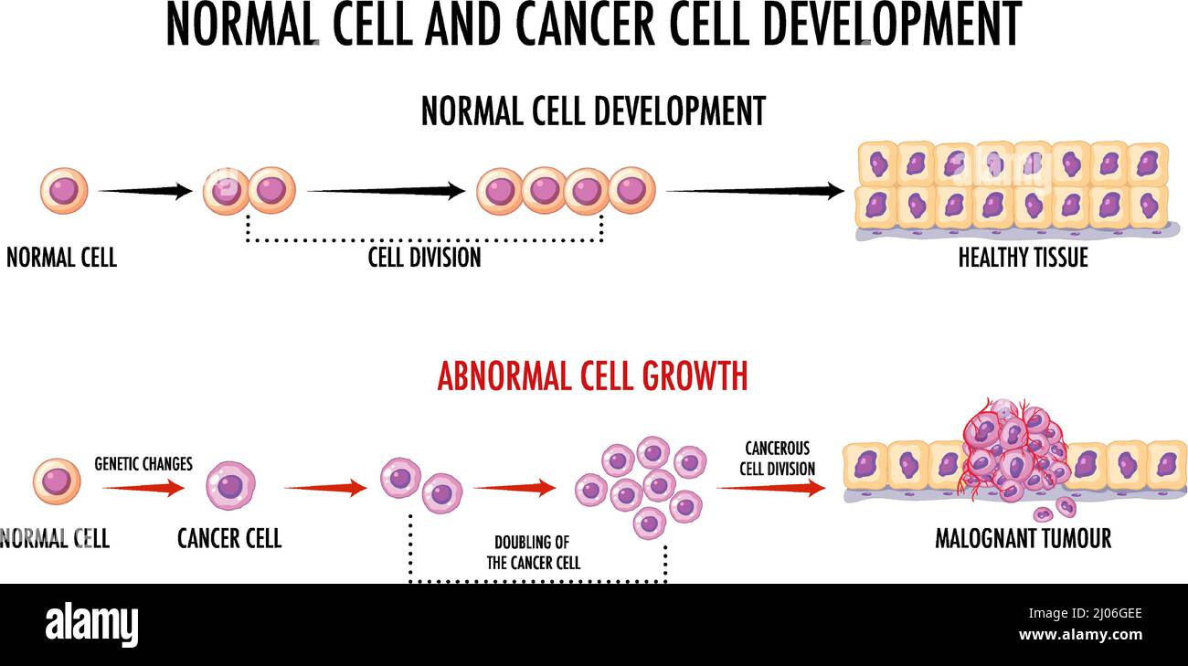 Diagram showing normal and cancer cells illustration Stock Vector Image ...