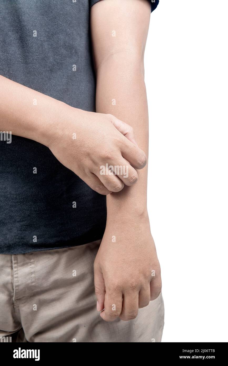 Man scratch the itch with hand isolated over white background Stock ...