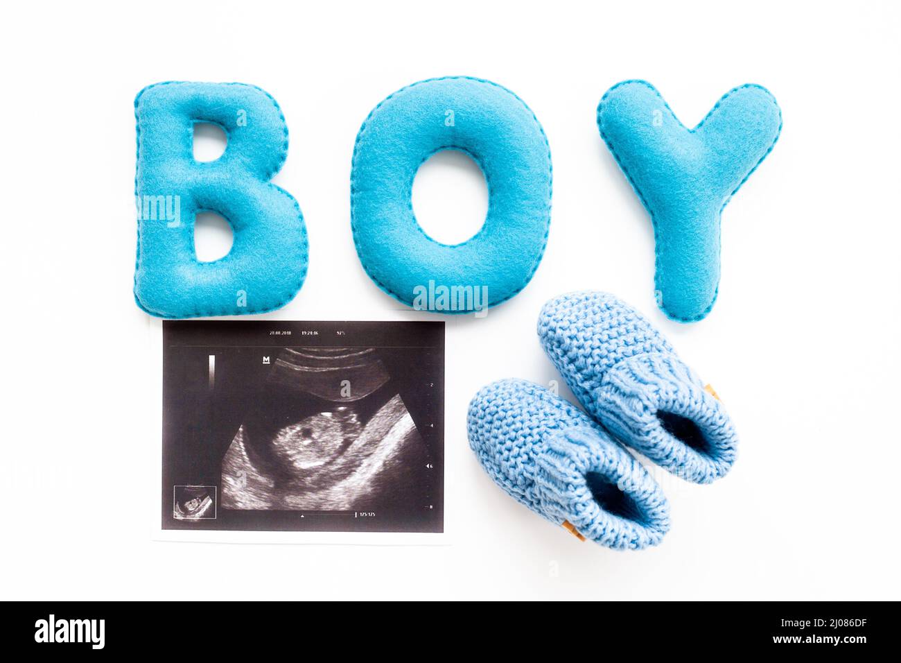 Ultrasound scan of unborn baby with letters boy Stock Photo - Alamy