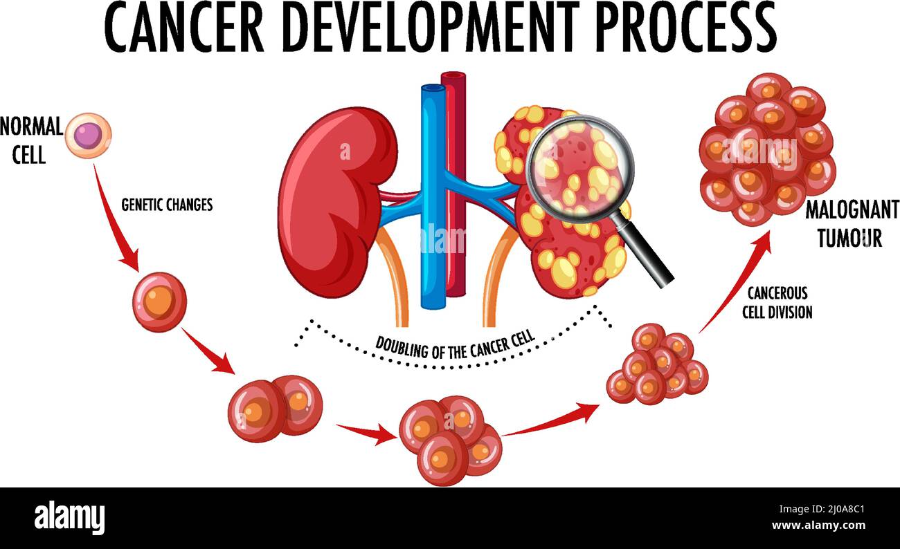 Cancer Cells Diagram