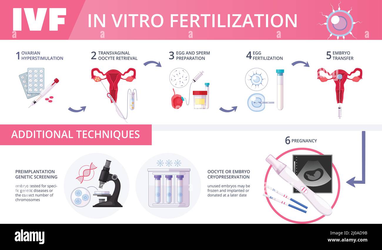 In Vitro Fertilization Steps
