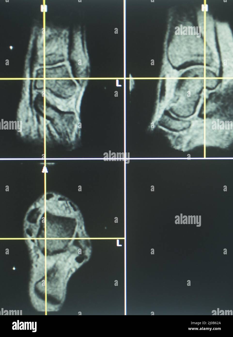 Open mri hi-res stock photography and images - Alamy