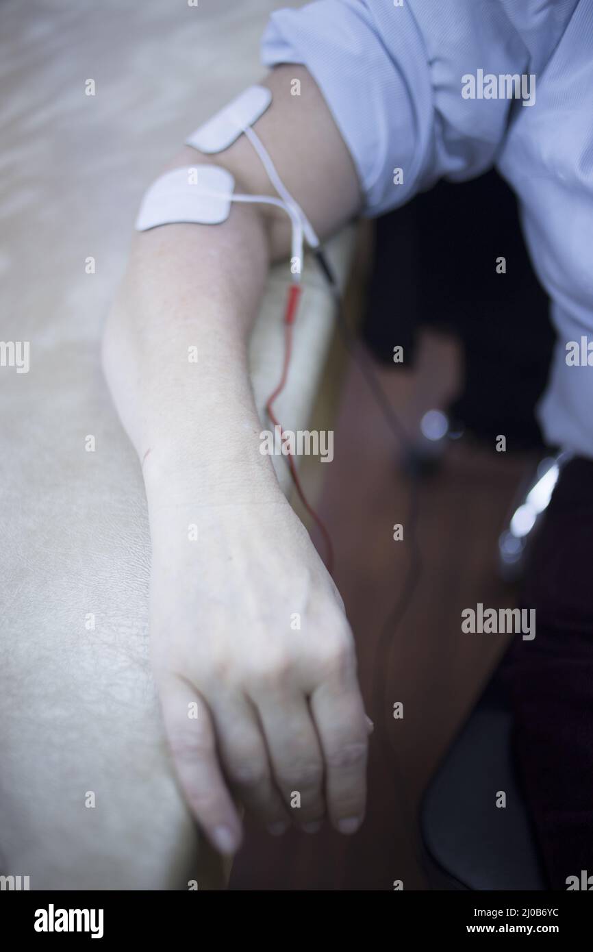Patient arm physiotherapy rehabiliation from injury Stock Photo - Alamy