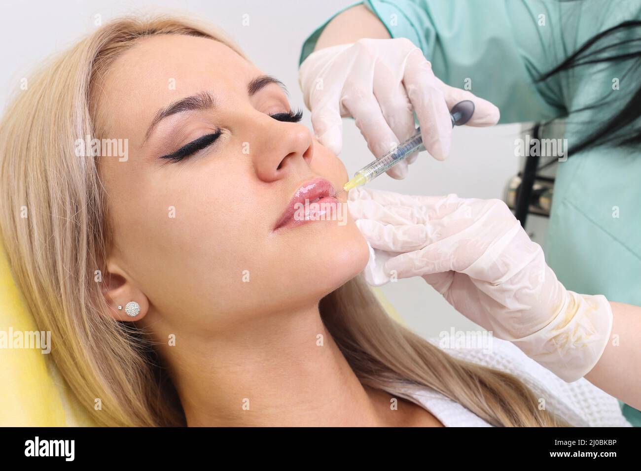 Collagen lips hi-res stock photography and images - Alamy