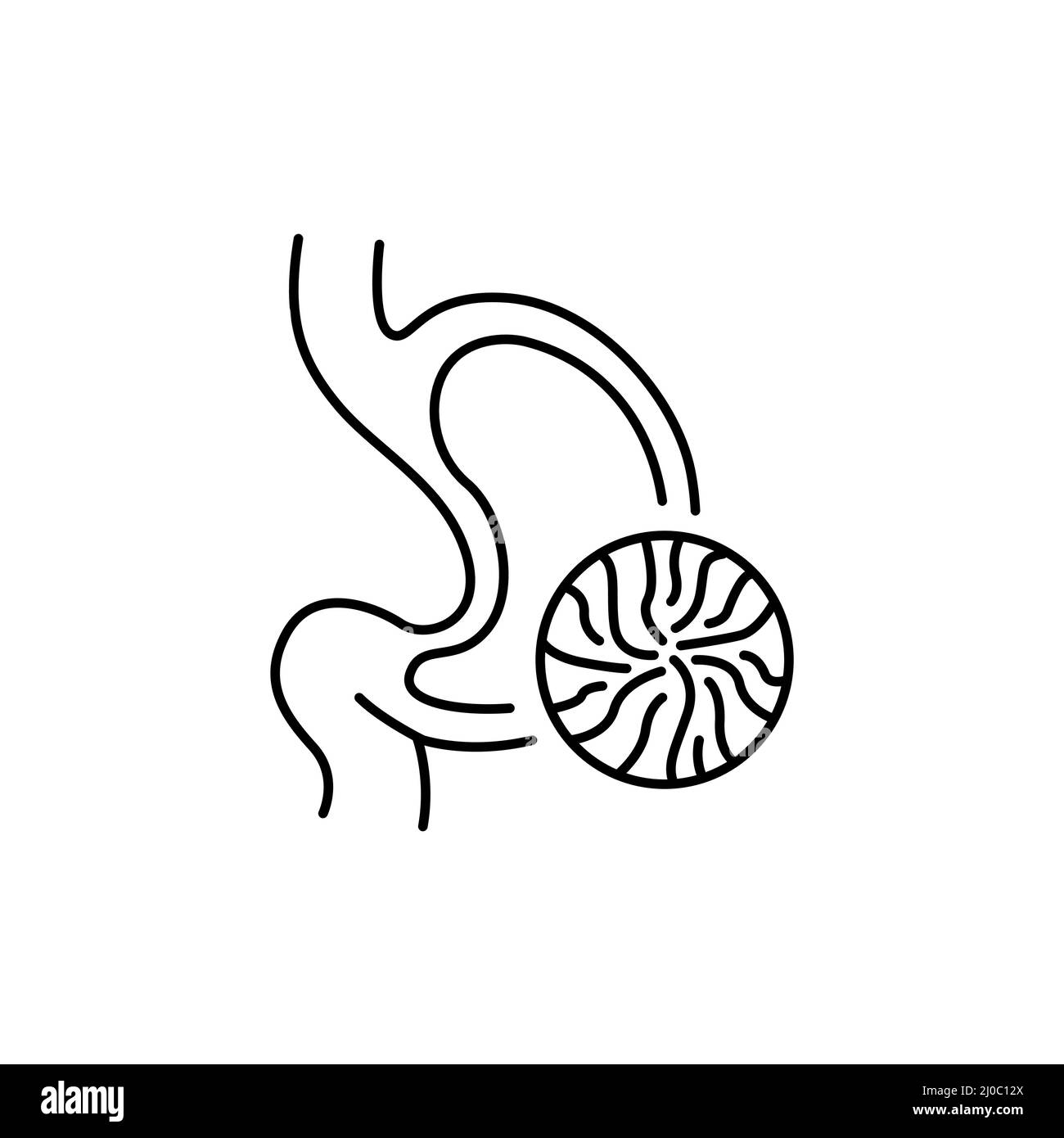 Stomach ulcer illustration Black and White Stock Photos & Images - Alamy