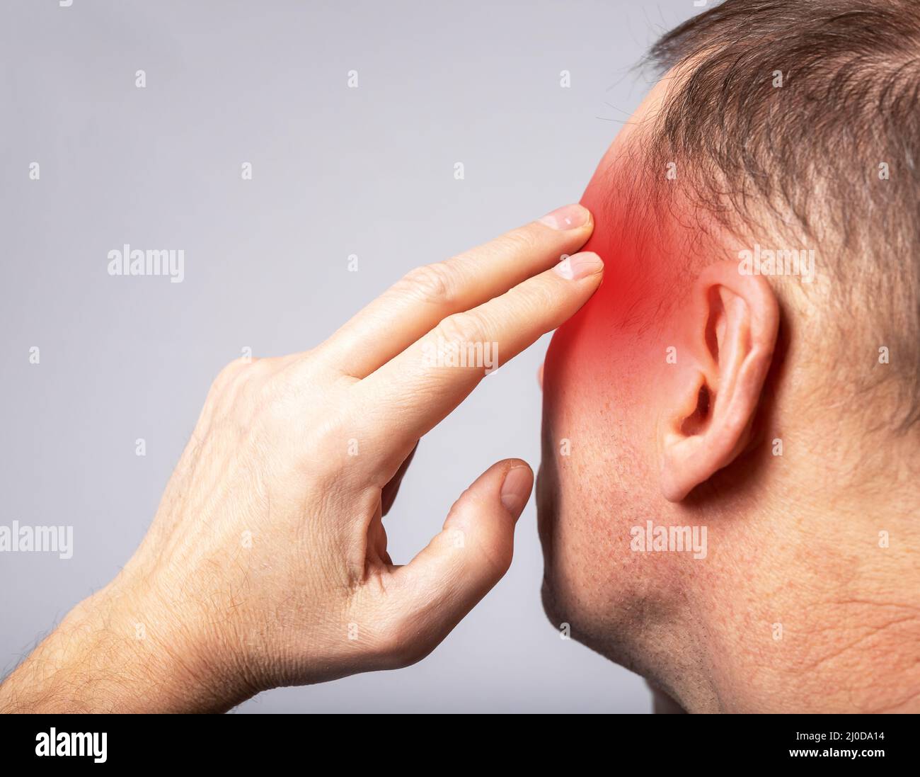 Man massaging temples. Headache, migraine, fatigue, health problems ...