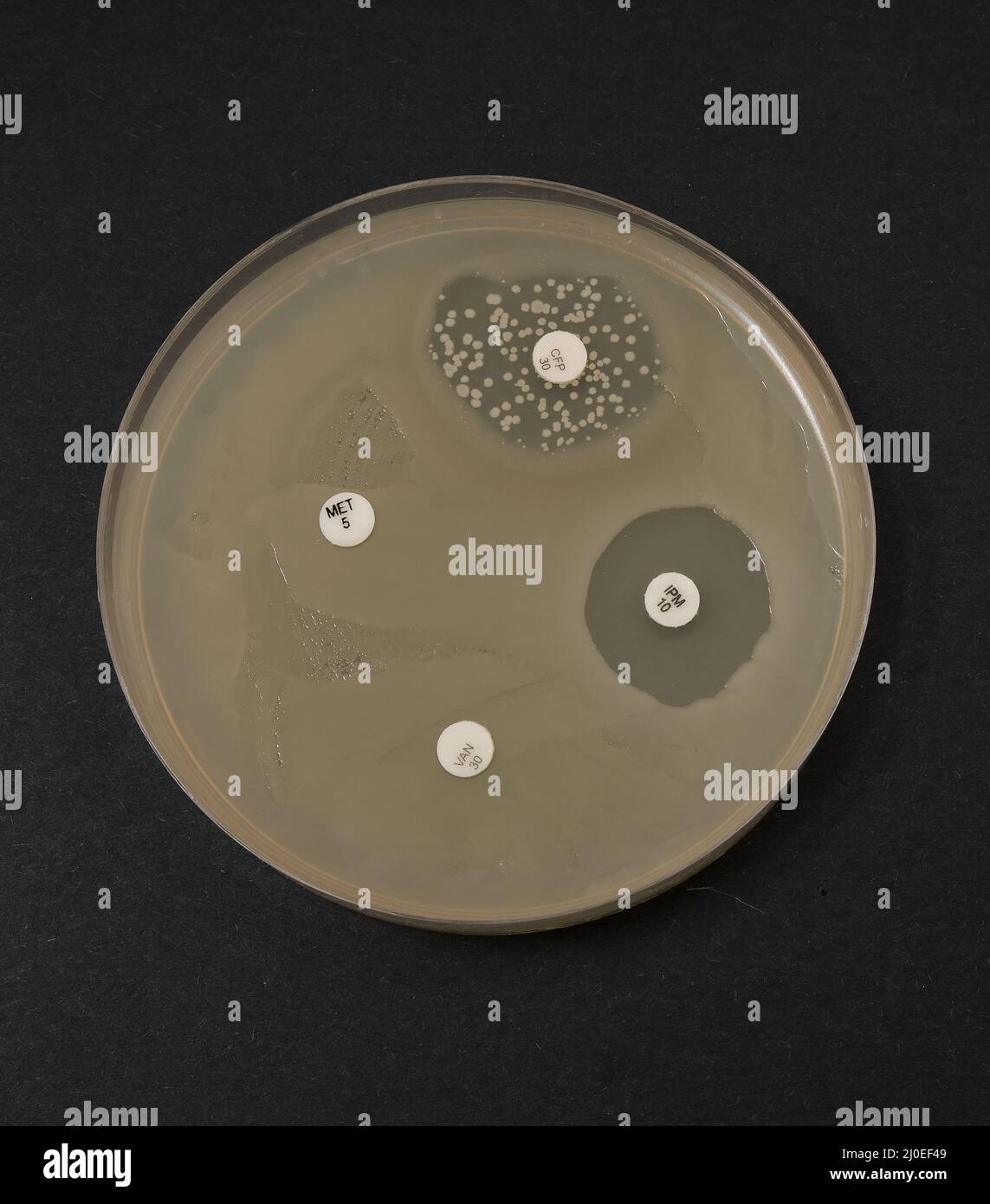 photo of growth of bacterial colonies around antibiotic discs Stock ...