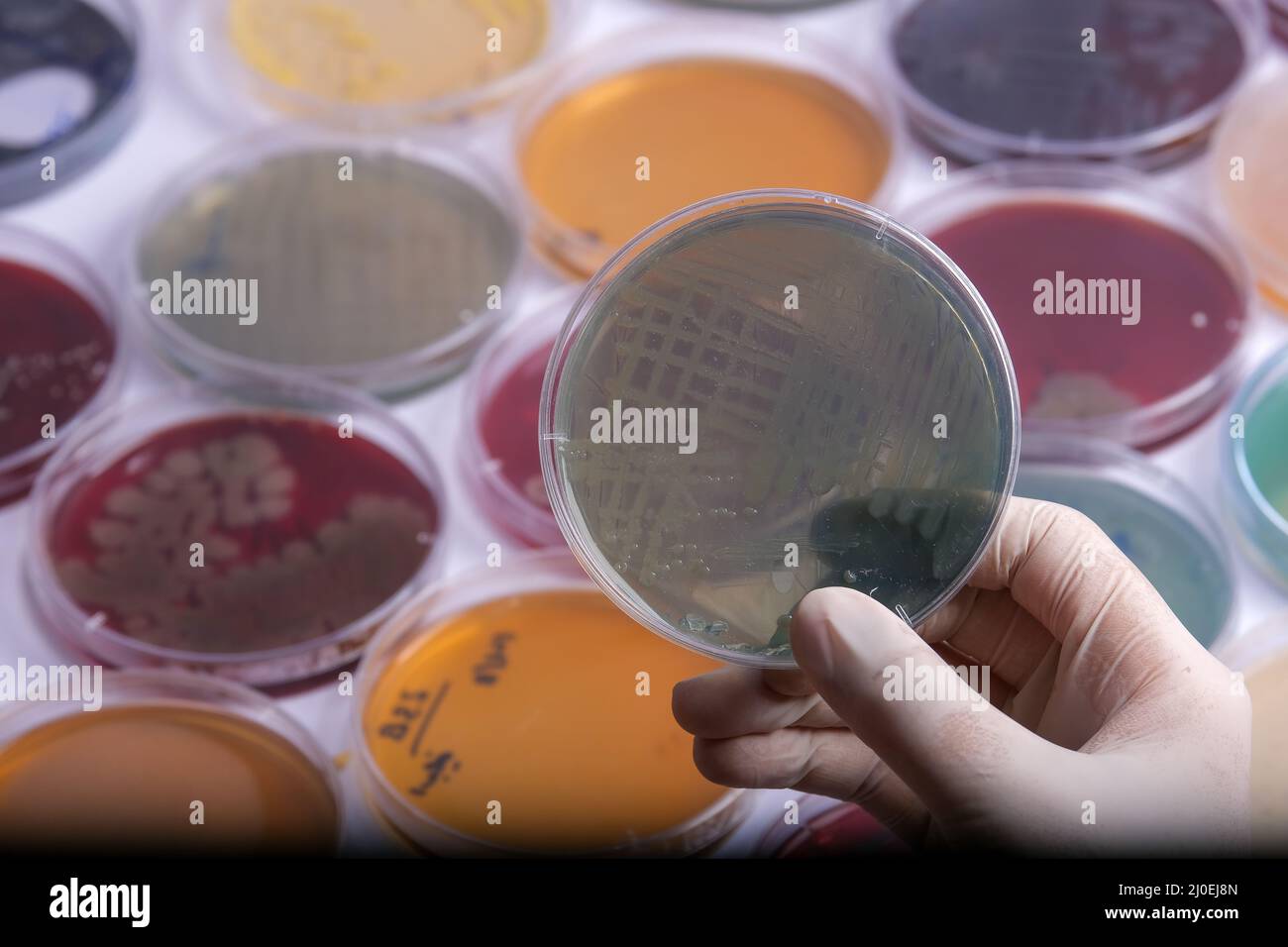 collection of culture plates contain growth of microorganisms on ...
