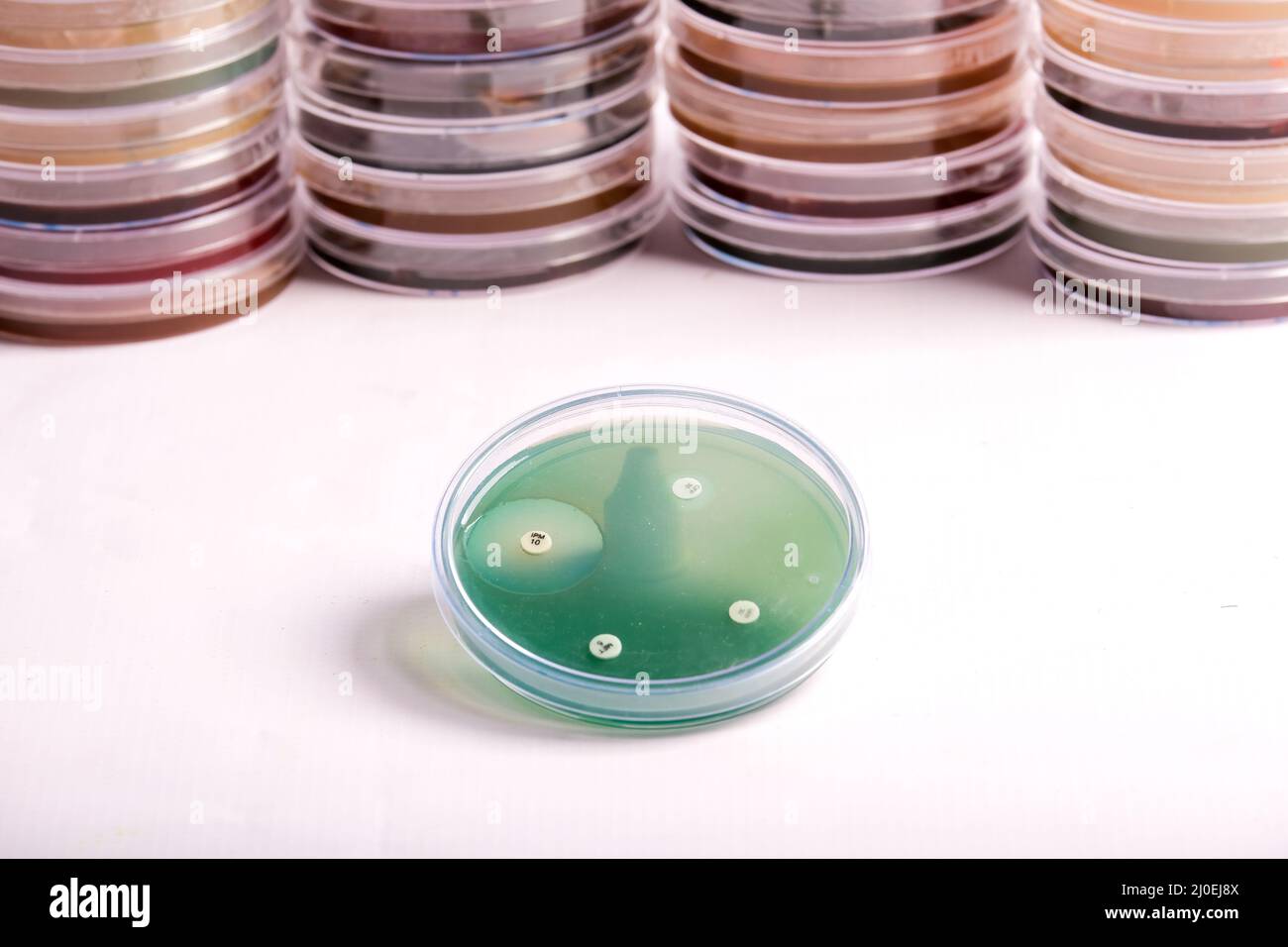 collection of culture plates contain growth of microorganisms on ...