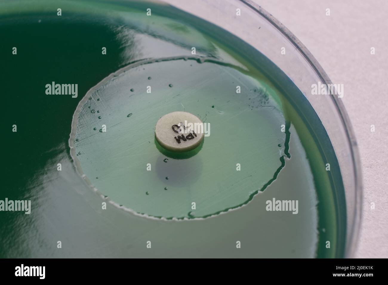 collection of culture plates contain growth of microorganisms on ...