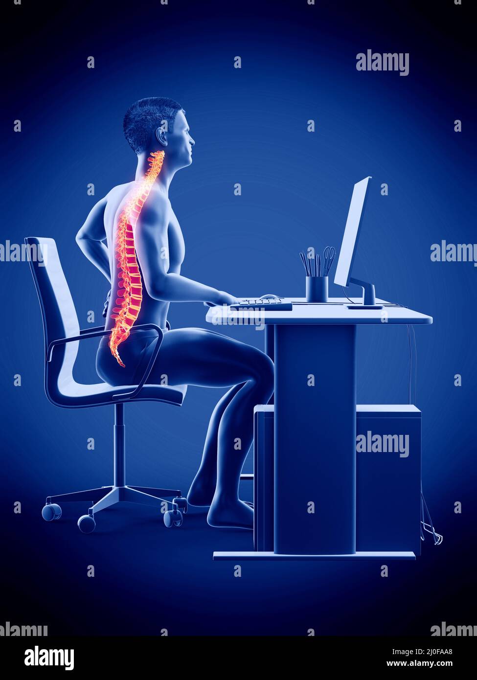 Office worker's painful back, illustration Stock Photo - Alamy