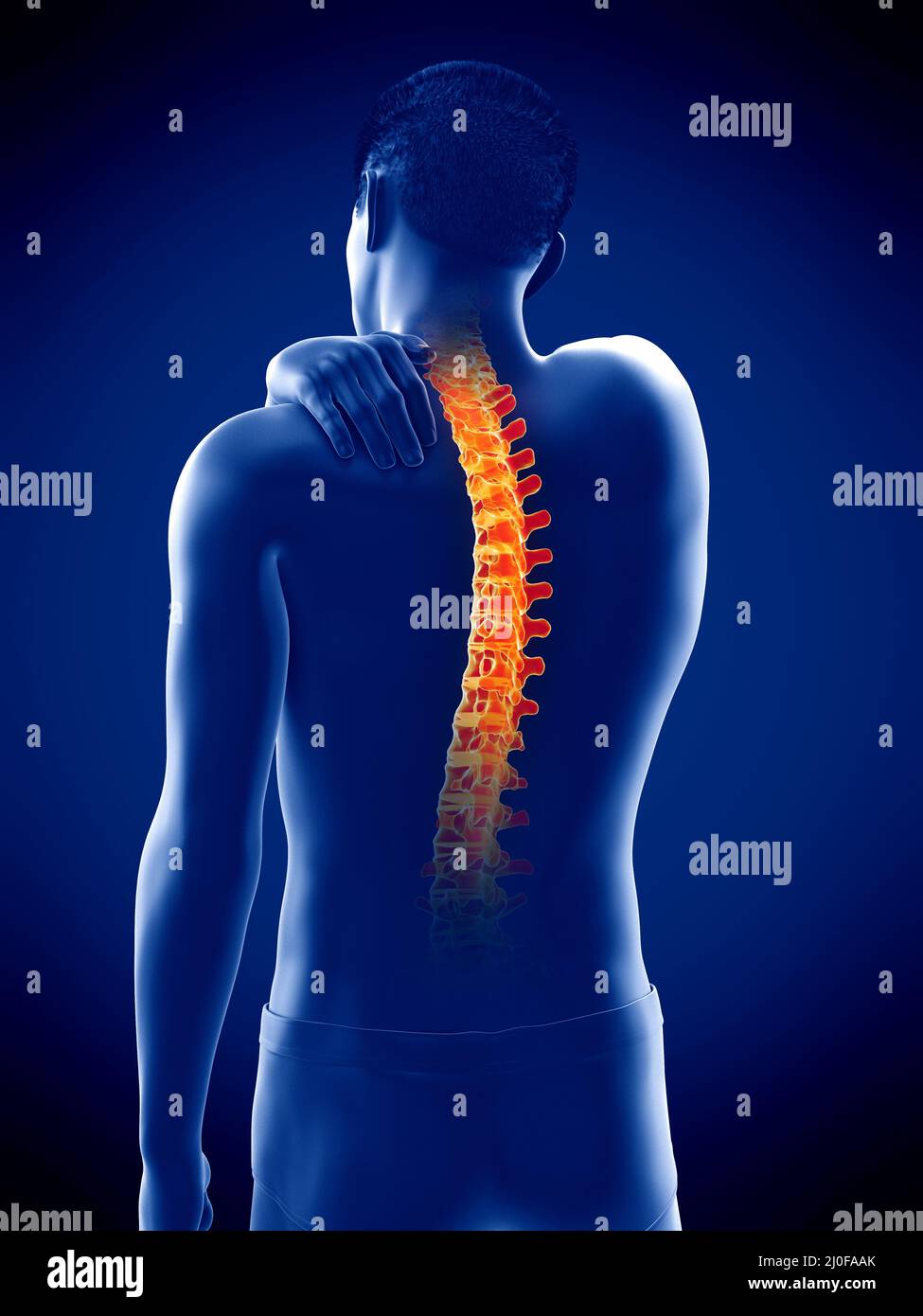 Man with backache, illustration Stock Photo - Alamy