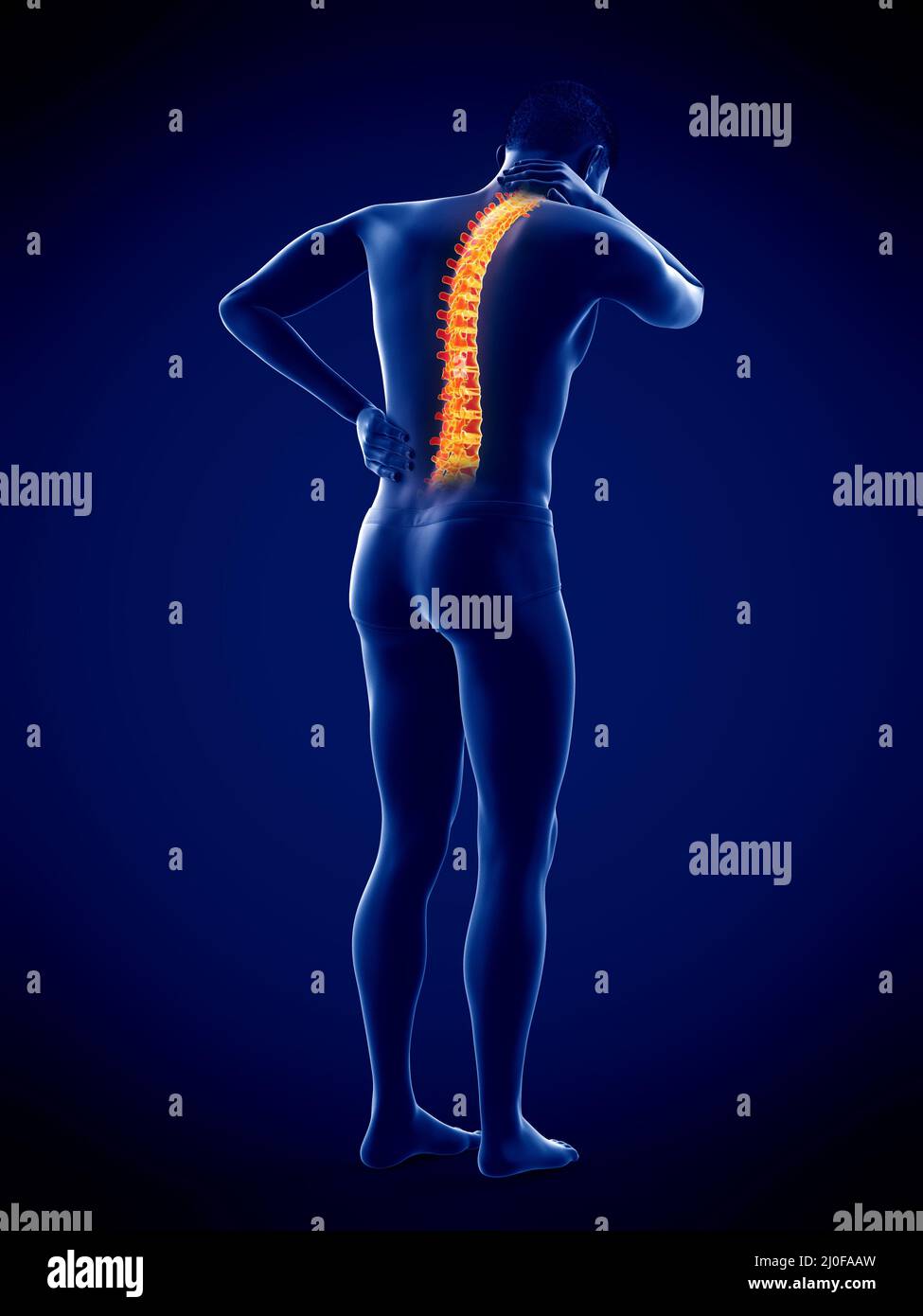 Man with backache, illustration Stock Photo - Alamy