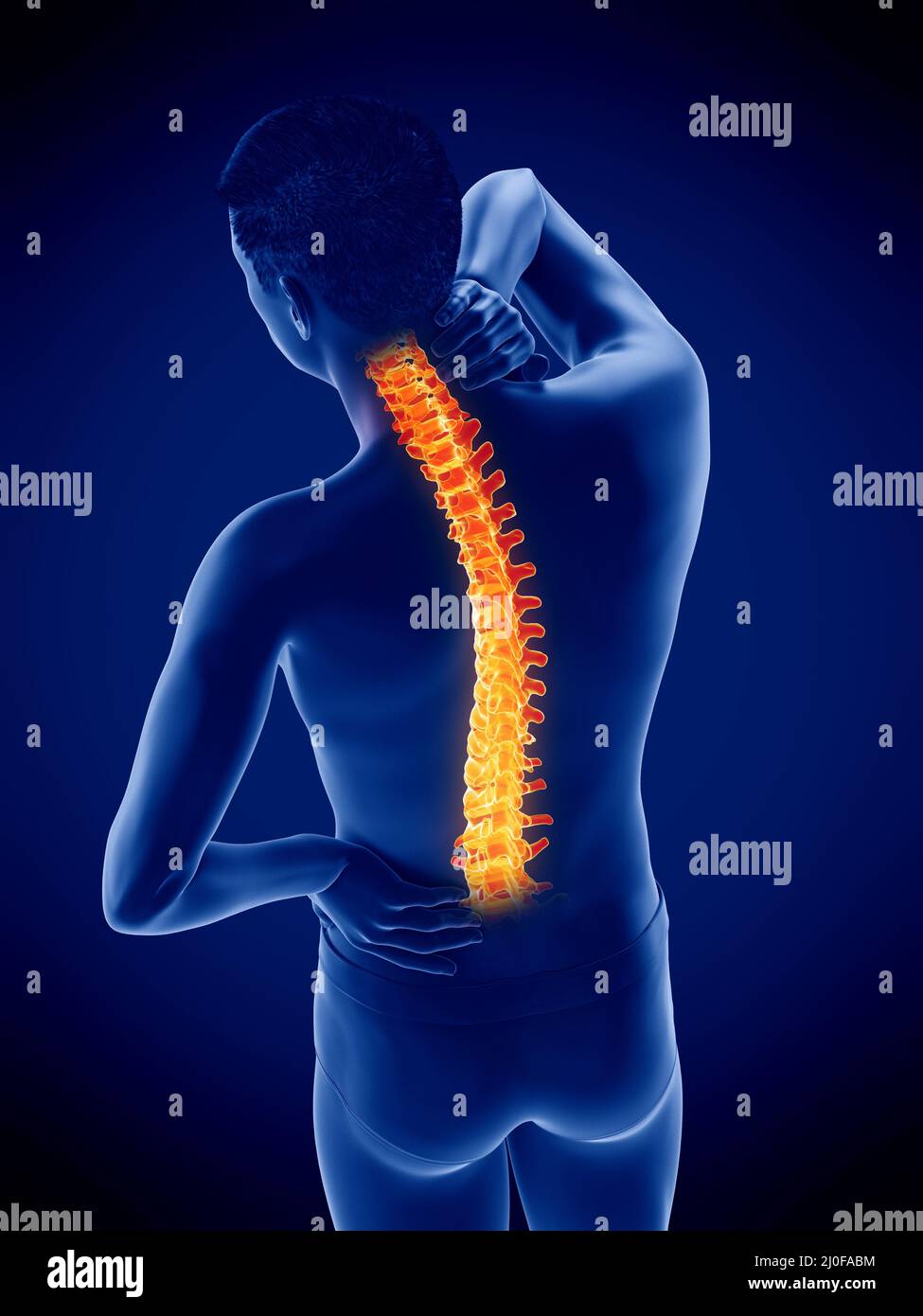 Man with backache, illustration Stock Photo - Alamy
