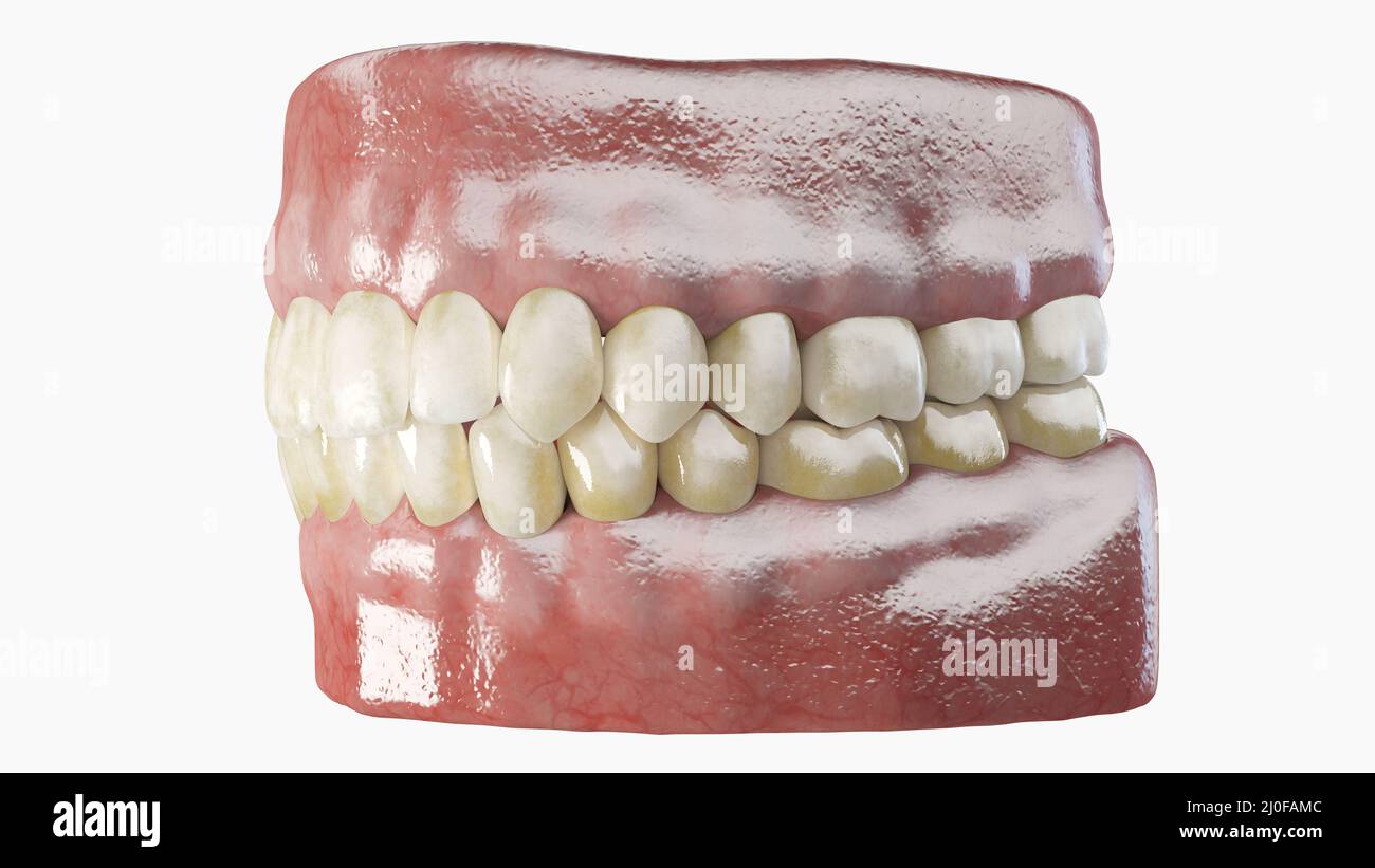 Dirty teeth, illustration Stock Photo - Alamy
