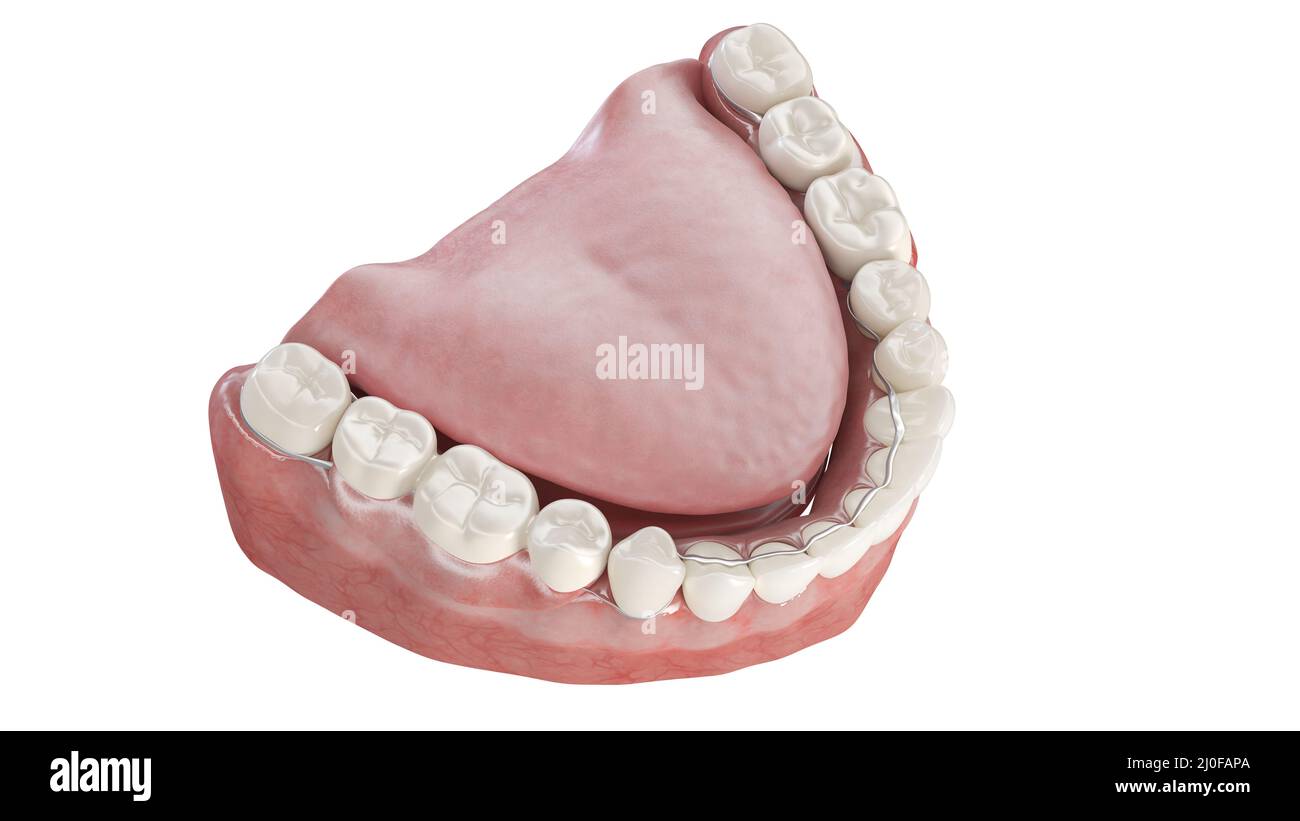Denture illustration Cut Out Stock Images & Pictures - Alamy