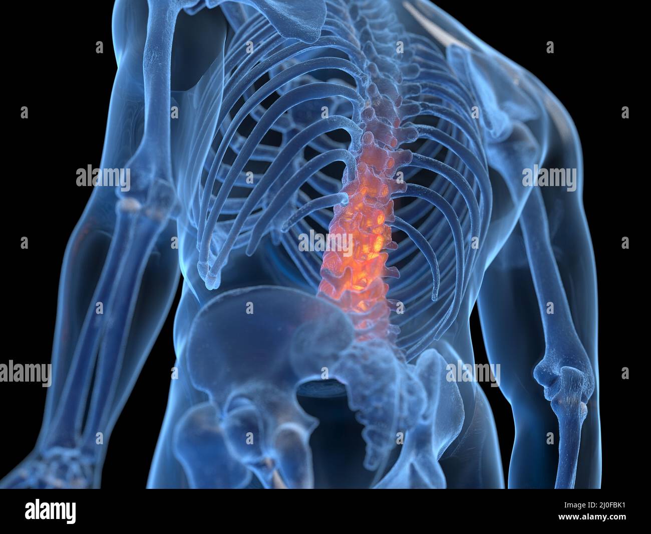 Inflamed back, illustration Stock Photo - Alamy