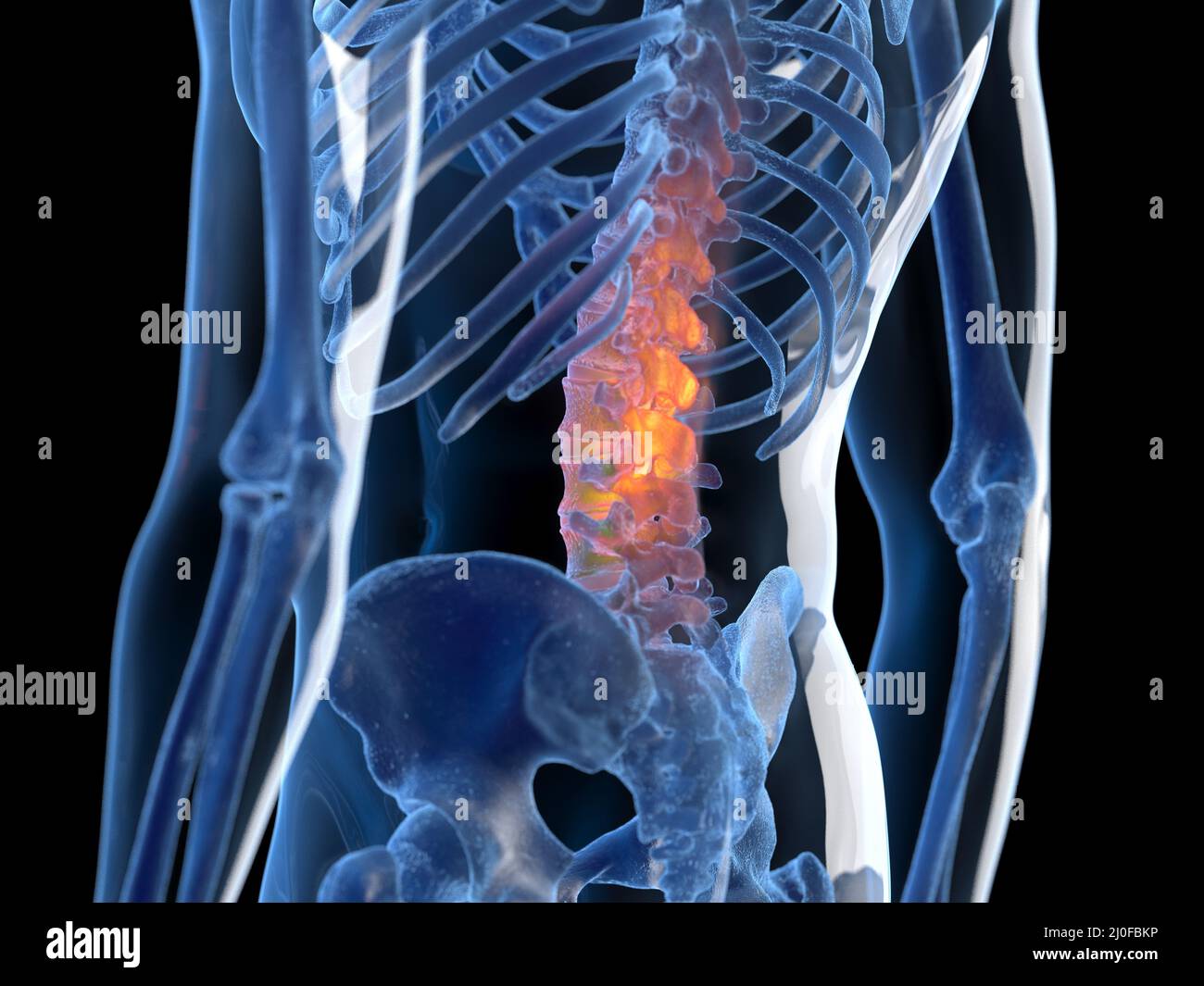 Inflamed back, illustration Stock Photo - Alamy