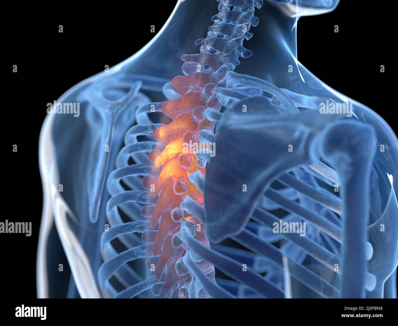 Painful thoracic spine, illustration Stock Photo - Alamy