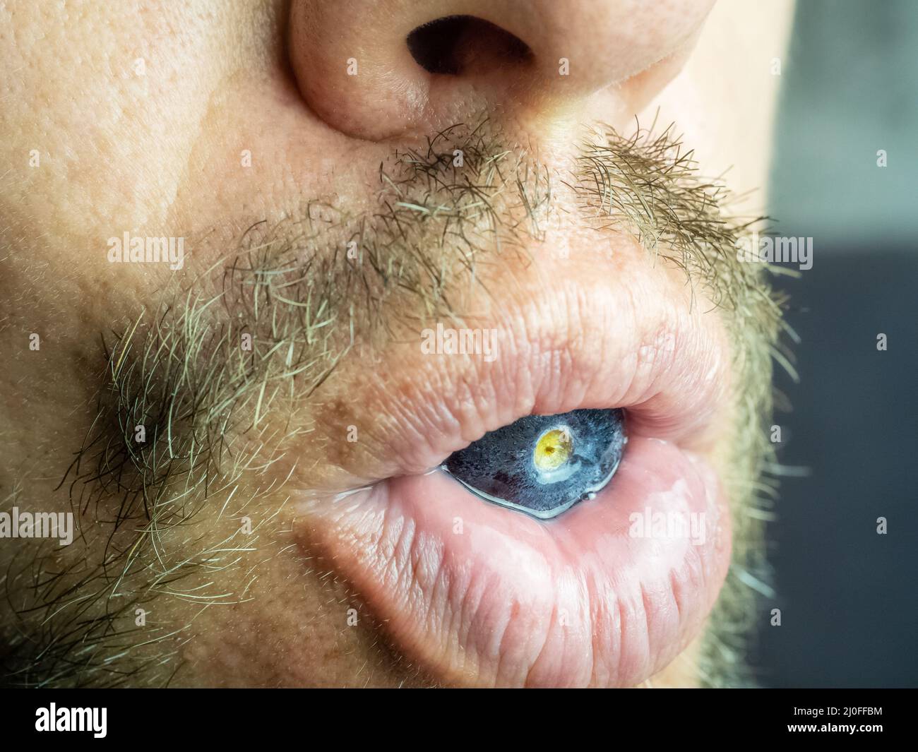 Fragment of a male face nose mouth mustache and blueberry berry in the ...