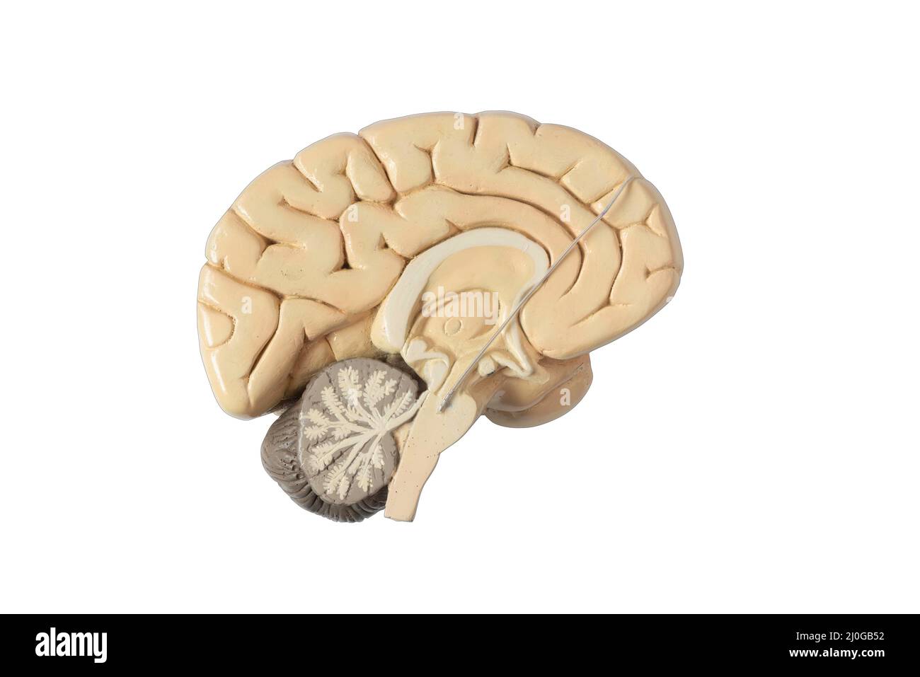 Deep brain stimulation at subthalamic nucleus for the treatment of ...