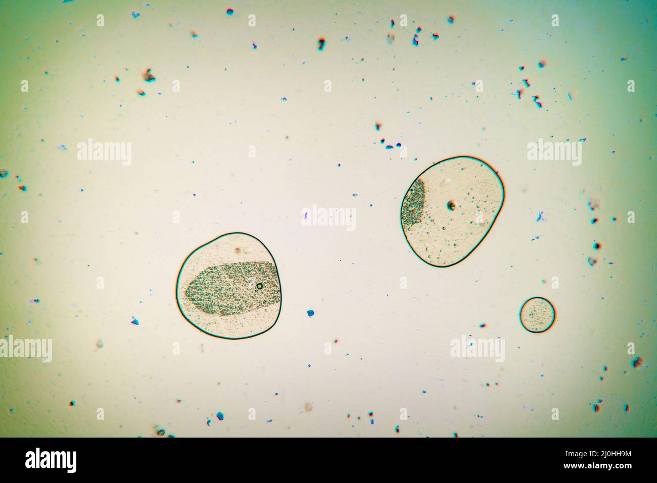 Biological fluid at a crime scene under a microscope as evidence of a ...