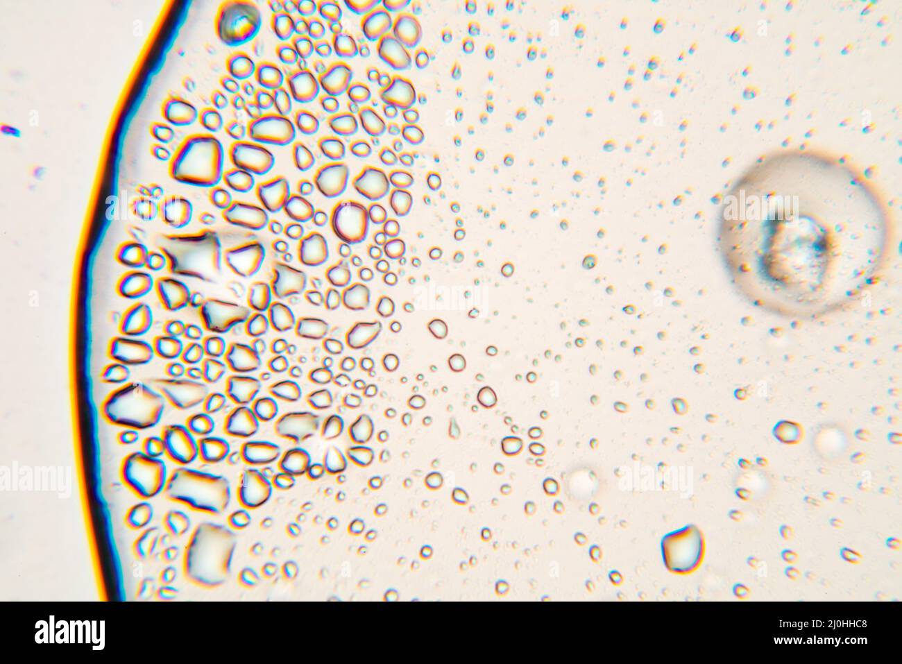 Biological fluid at a crime scene under a microscope as evidence of a ...