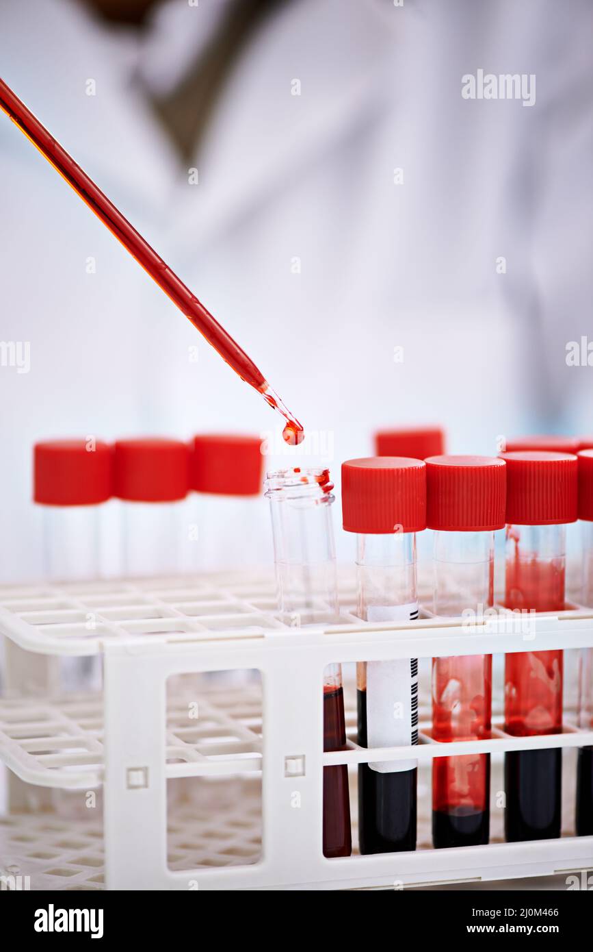Taking a closer look at your blood. Cropped shot of a scientist working ...